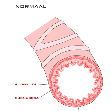 Longen - Medische informatie - Astma - CyberPoli